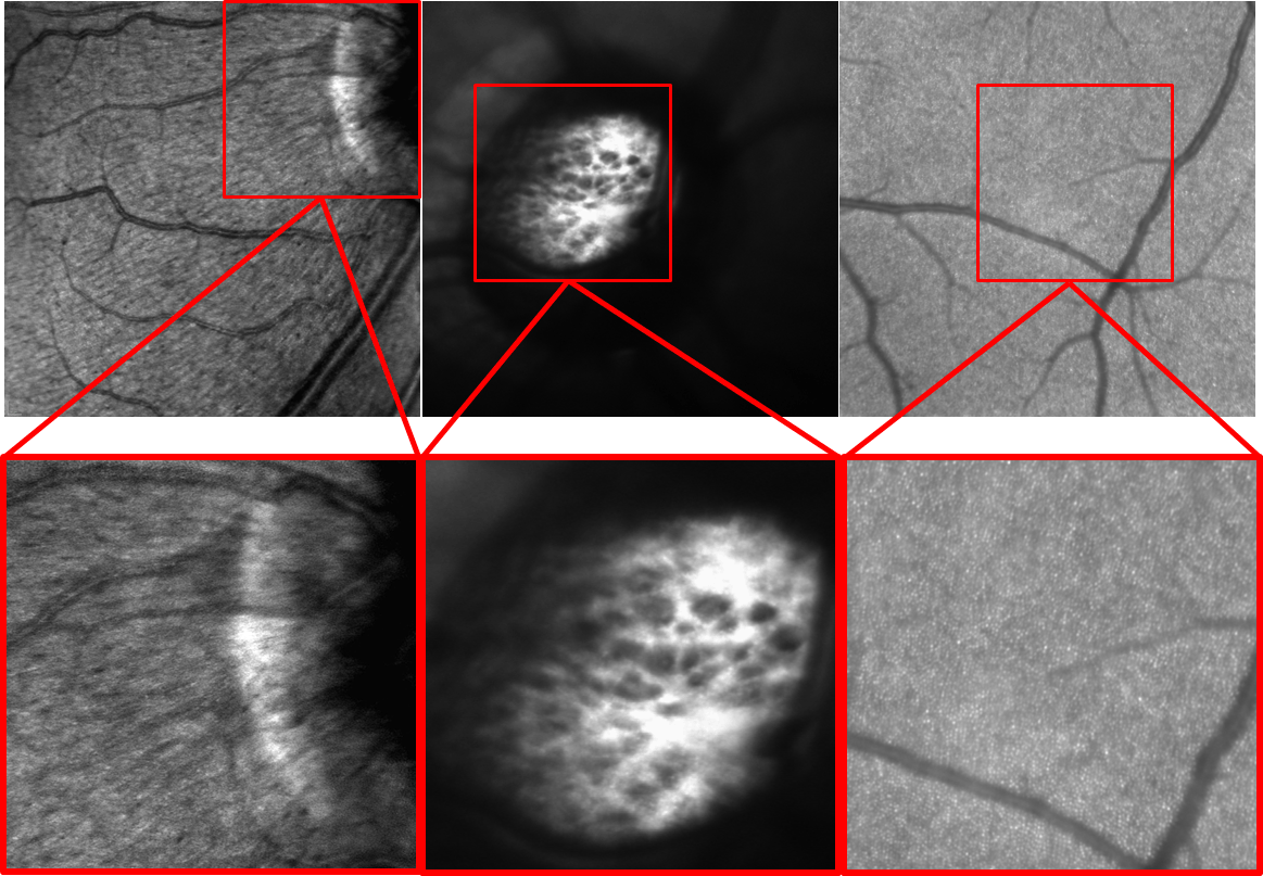 Spectralis High Magnification Module Receives CE Marking - Eyewire+