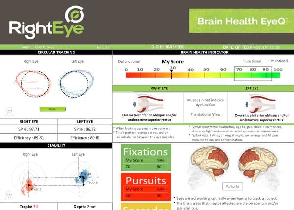 RightEye Builds Database of One Billion Eye Tracking Data Points - Eyewire+