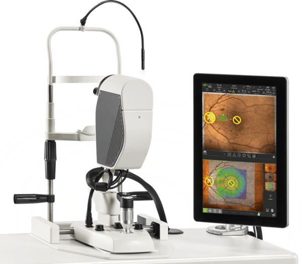 OD-OS to Showcase Navilas Navigated Retinal Laser Therapy at EURETINA ...